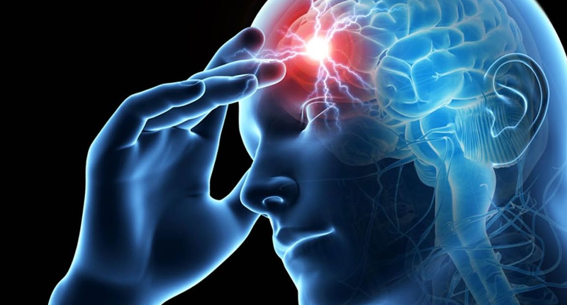 Neurología y Neurocirugía - Centro Medico Escalón